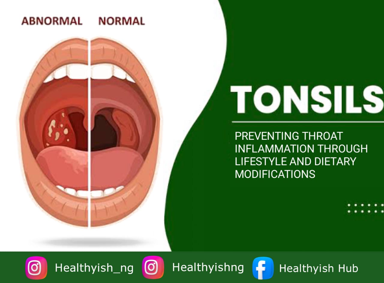 PREVENTING THROAT INFLAMMATION THROUGH LIFESTYLE AND DIETARY ...