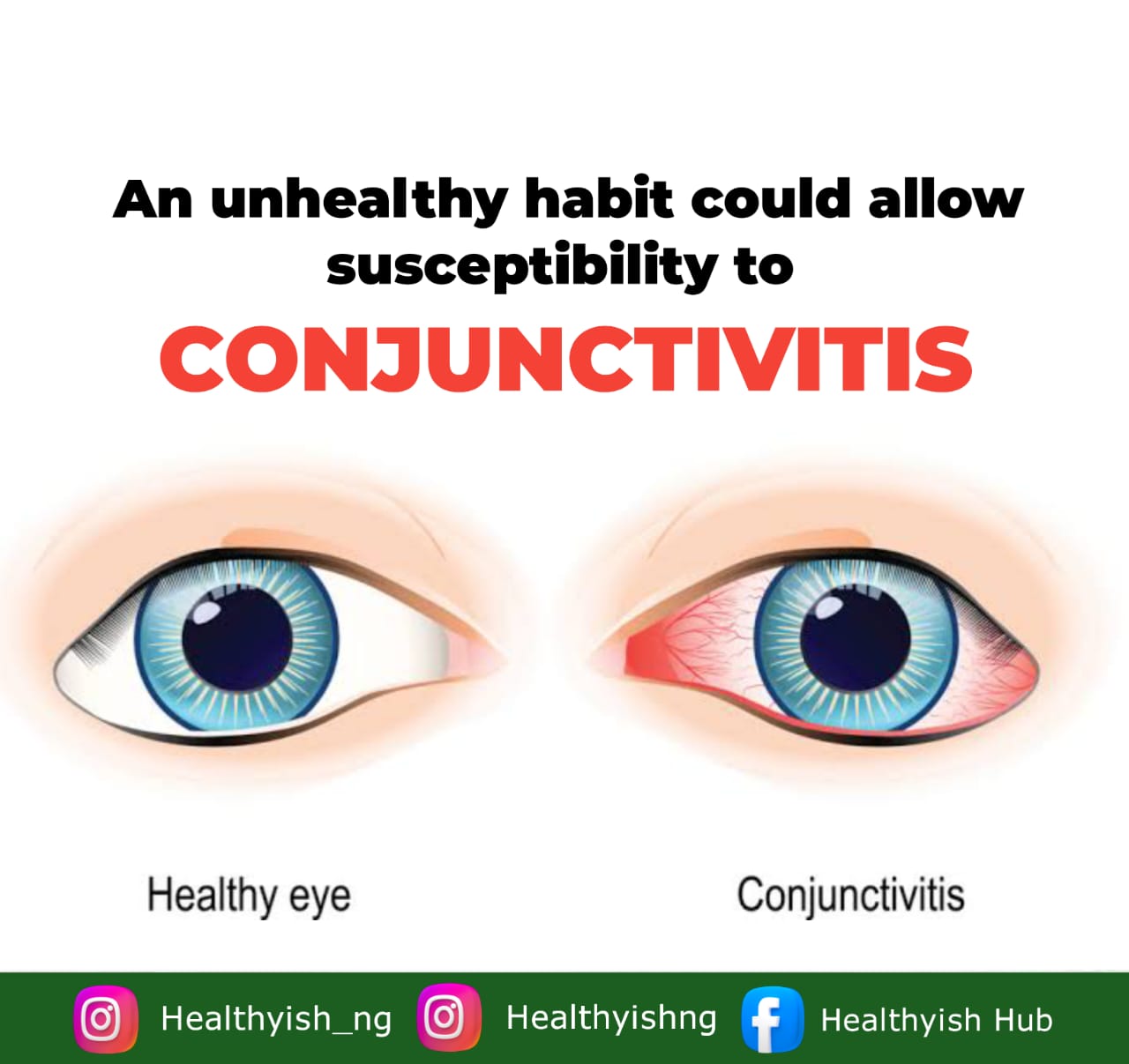 PREVENTING CONJUCTIVITIS; AN INFLAMMATORY DISEASE :: Healthyish